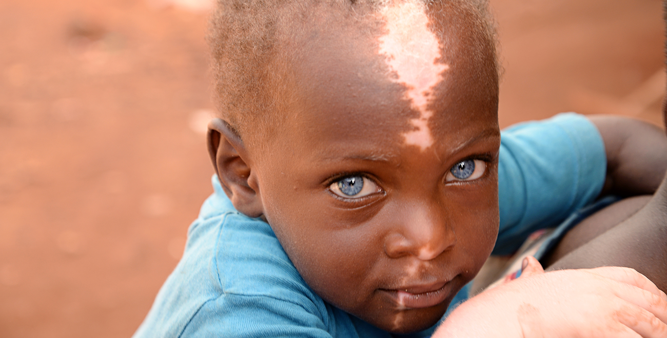 The blue eyed baby no longer abandoned | Compassion UK