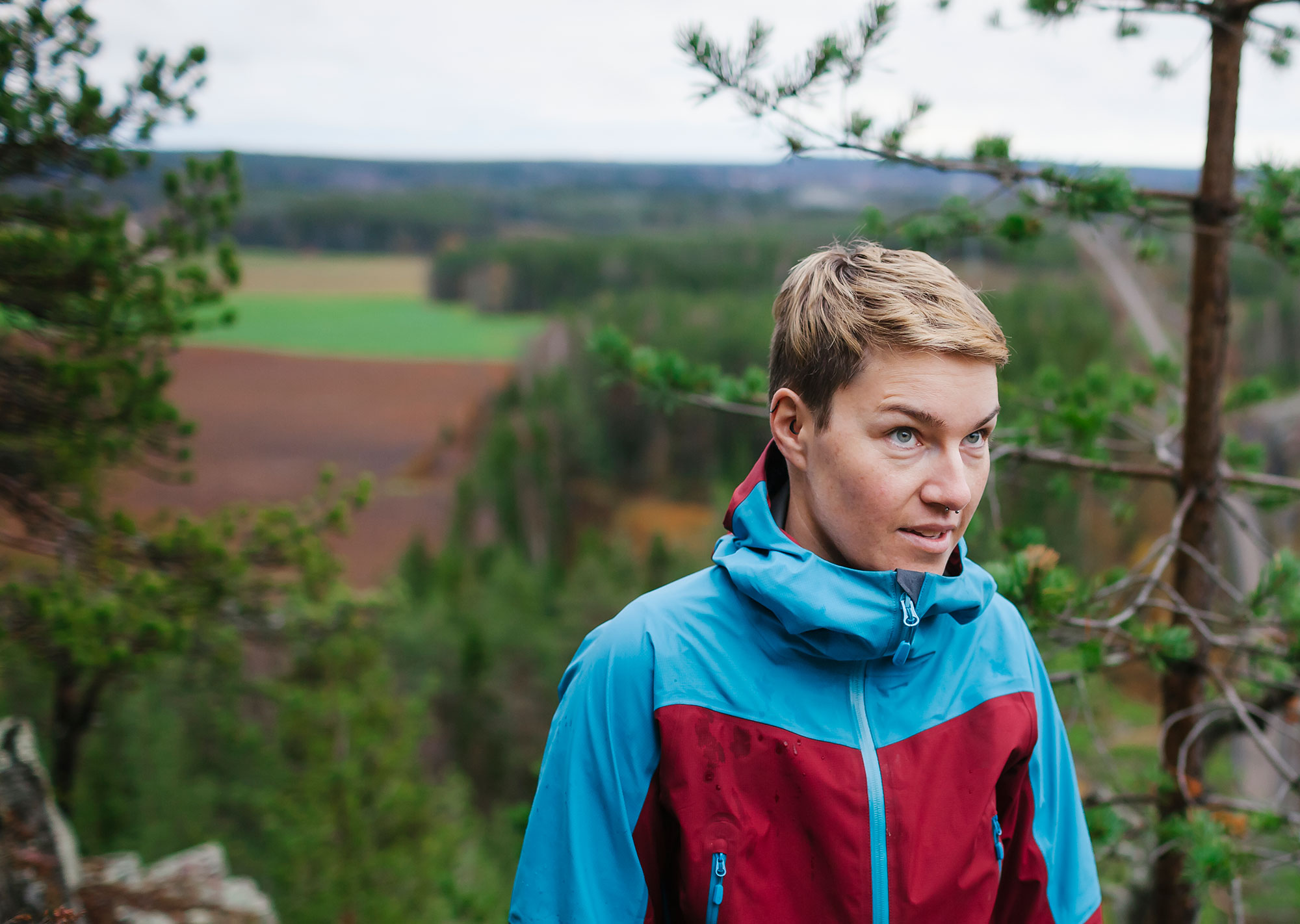 Ruoka-allergian oireet