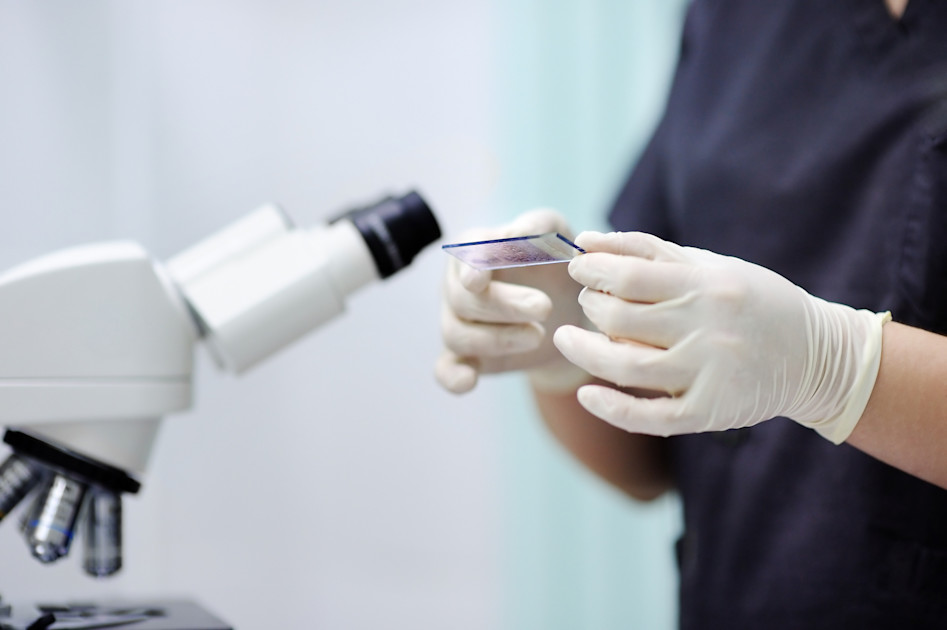 Benmärgsundersökningar i diagnostiseringen och behandlingen av leukemi ...