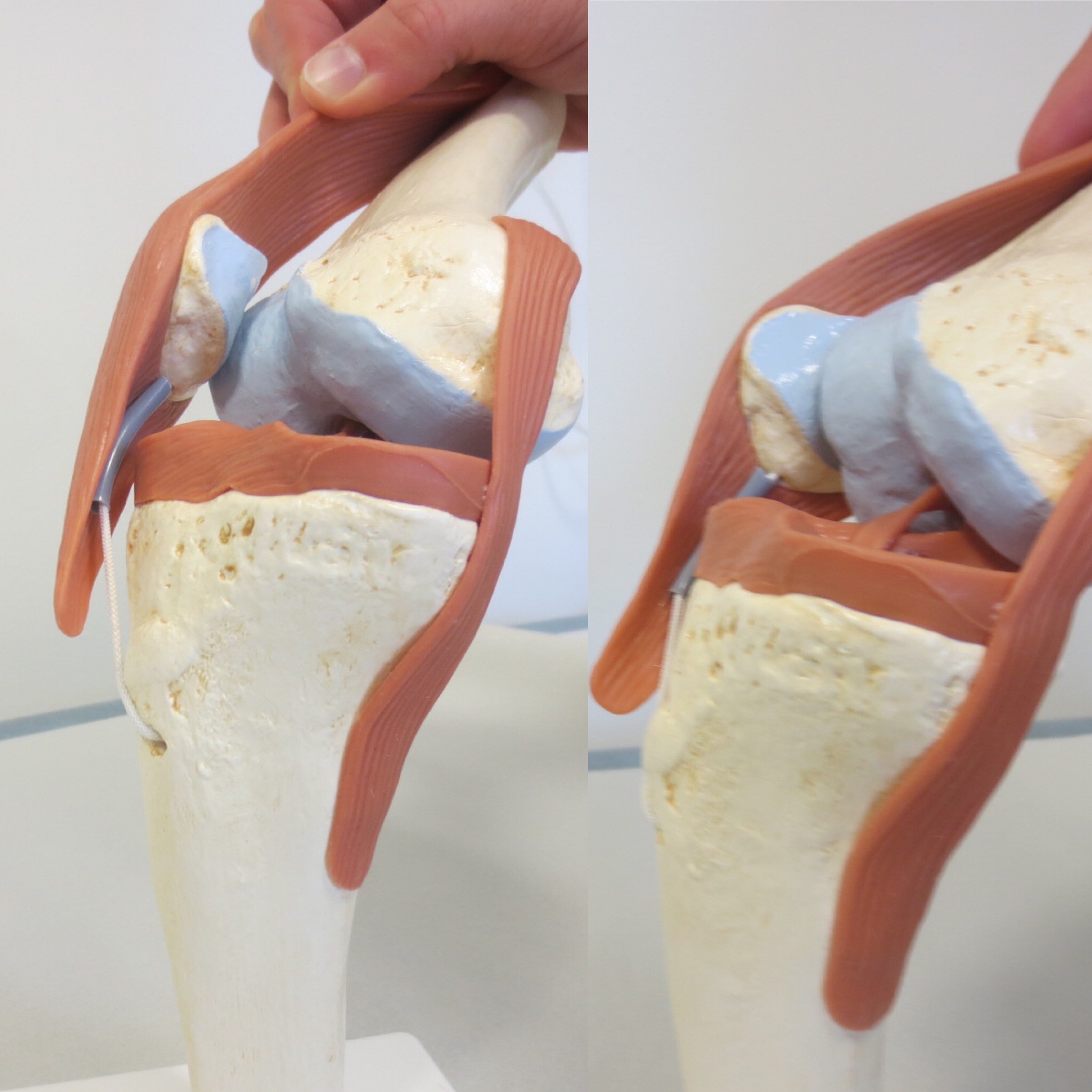 Polvilumpion sijoiltaanmeno